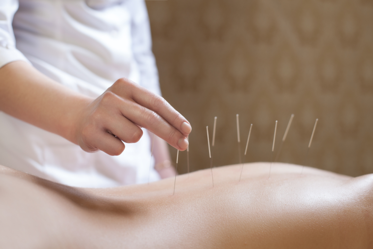 Does Acupuncture Work for Pain? The Evidence | Liu Clinic